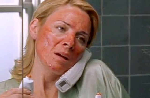 Acné rosacée : qu'est-ce que c'est, comment la reconnaître et la traiter